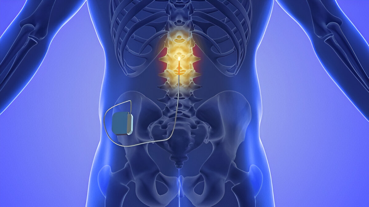 Interventional Pain Procedures | Neurology & Pain Management Center
